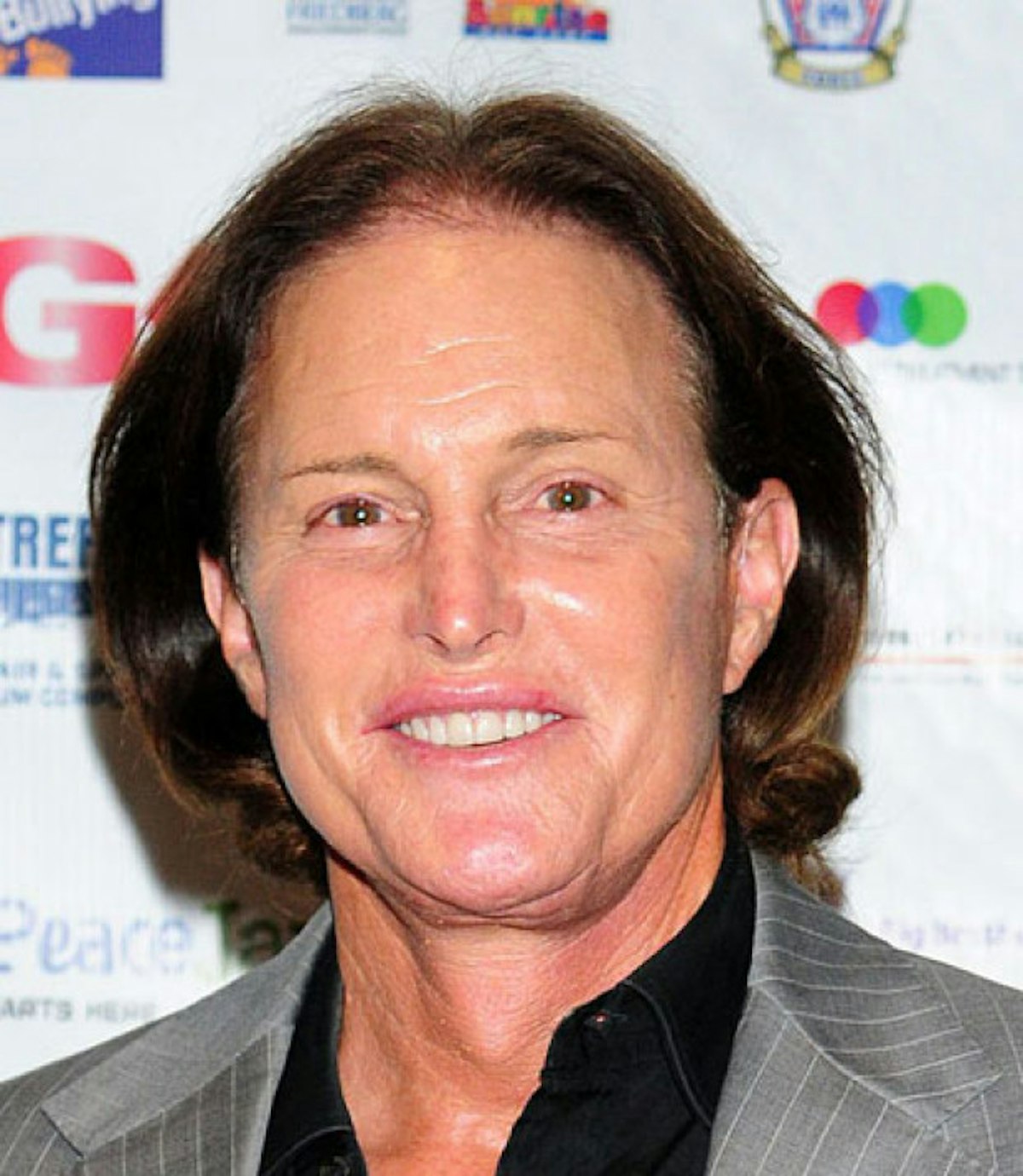 Plastic surgery timeline – the changing face of Bruce Jenner ...