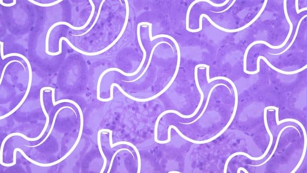 New Study Shows That Acid Reflux Medication Increases Chance Of Stomach ...