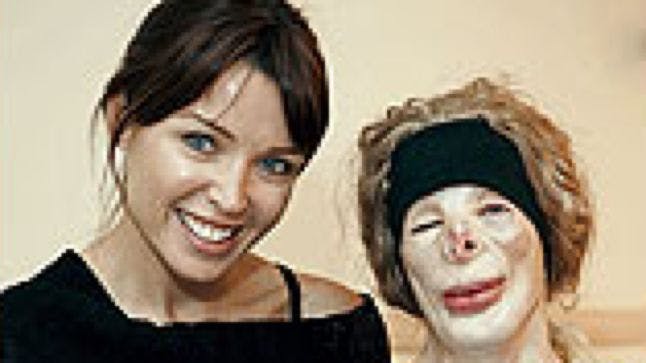Burns victim Terri Calvesbert: ‘Meeting my X Factor idols was a dream ...
