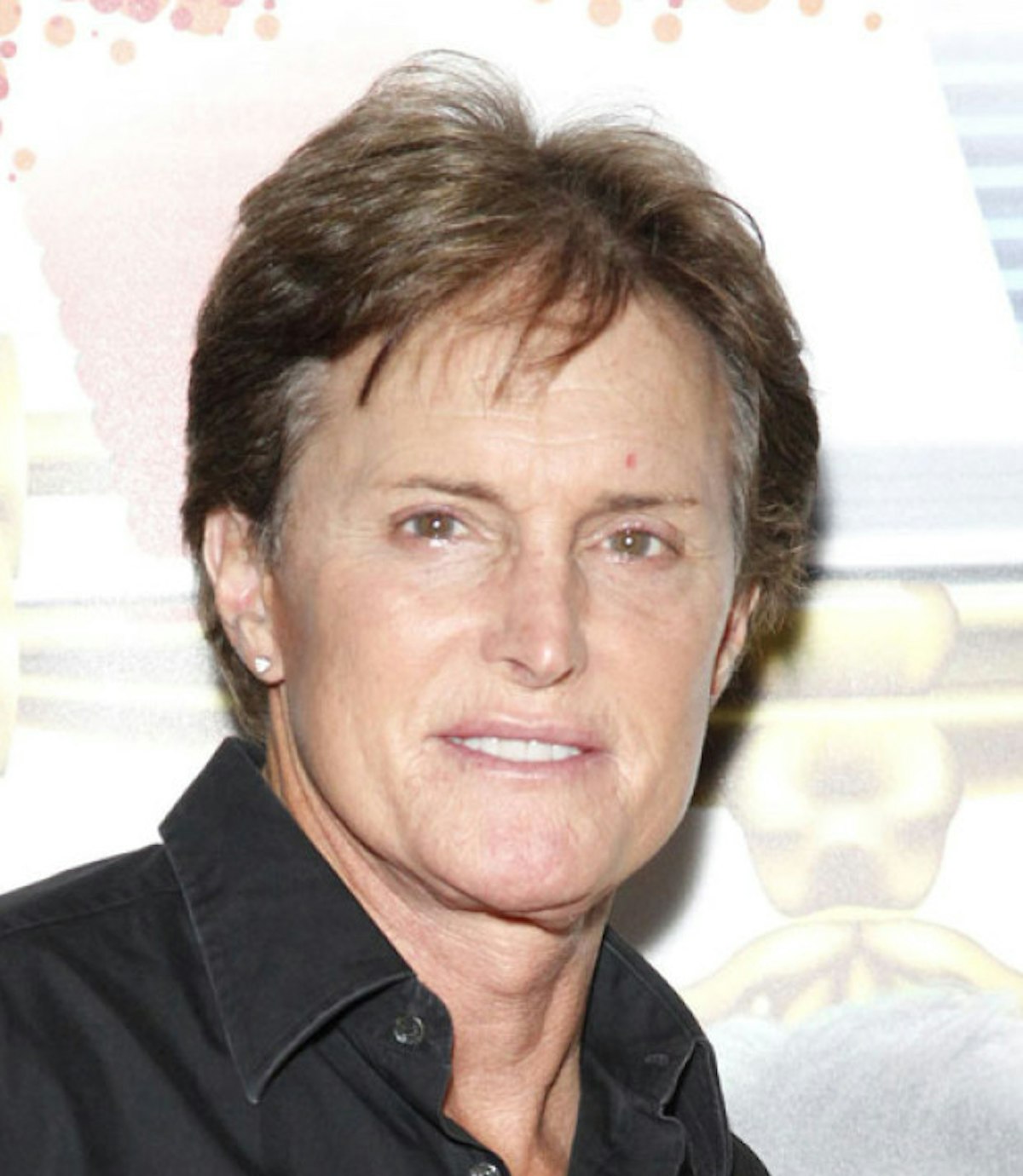 Plastic surgery timeline – the changing face of Bruce Jenner ...