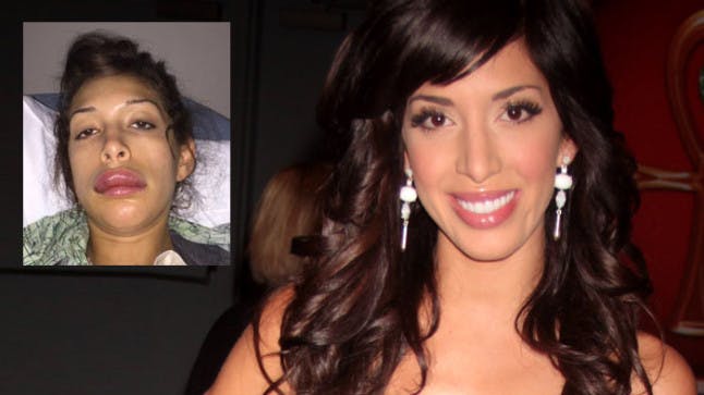 Teen Mom’s Farrah Abraham reveals shocking plastic surgery mishap | Closer