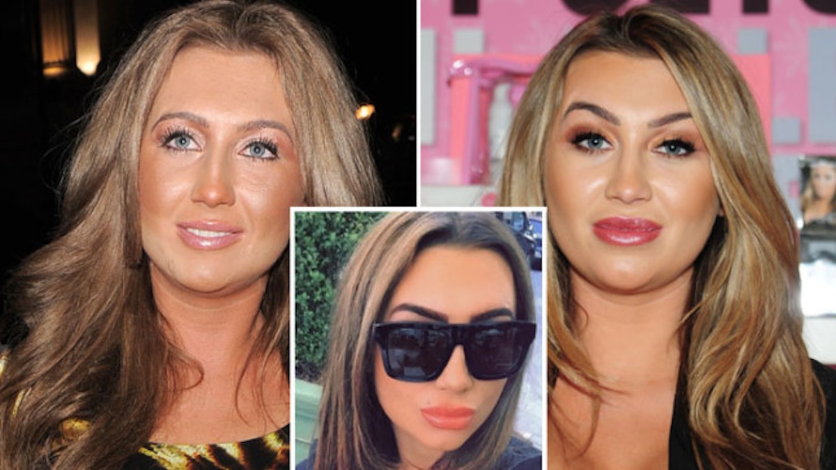 The most dramatic celebrity lip transformations of all time | Closer