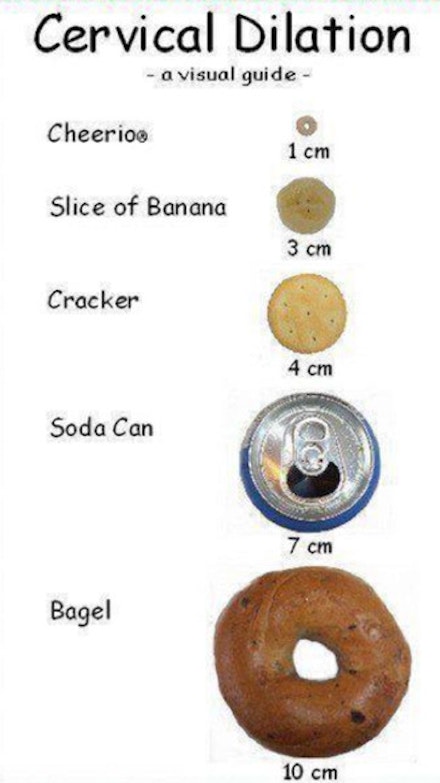 Pregnant mothers, here’s a visual guide to cervical dilation. Gulp ...