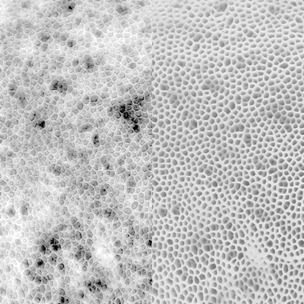 What Is Trypophobia: The Fear Of Holes That You've Probably Got | Life ...