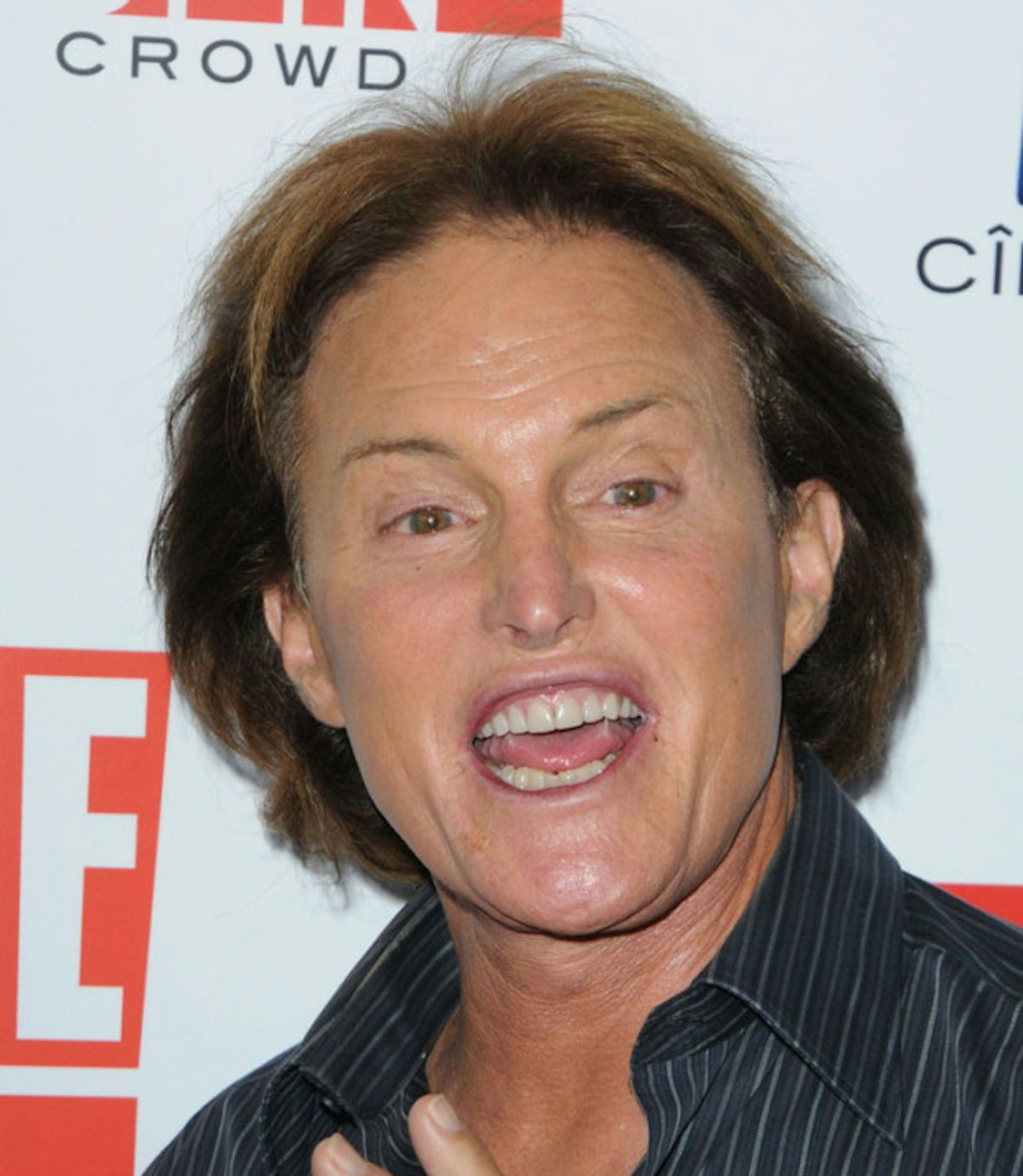 Plastic surgery timeline – the changing face of Bruce Jenner ...