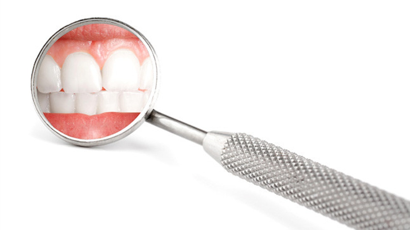 17-year-old boy has 232 teeth removed | Closer