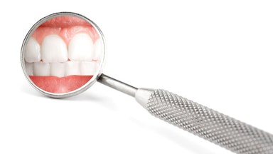 17-year-old boy has 232 teeth removed | Closer