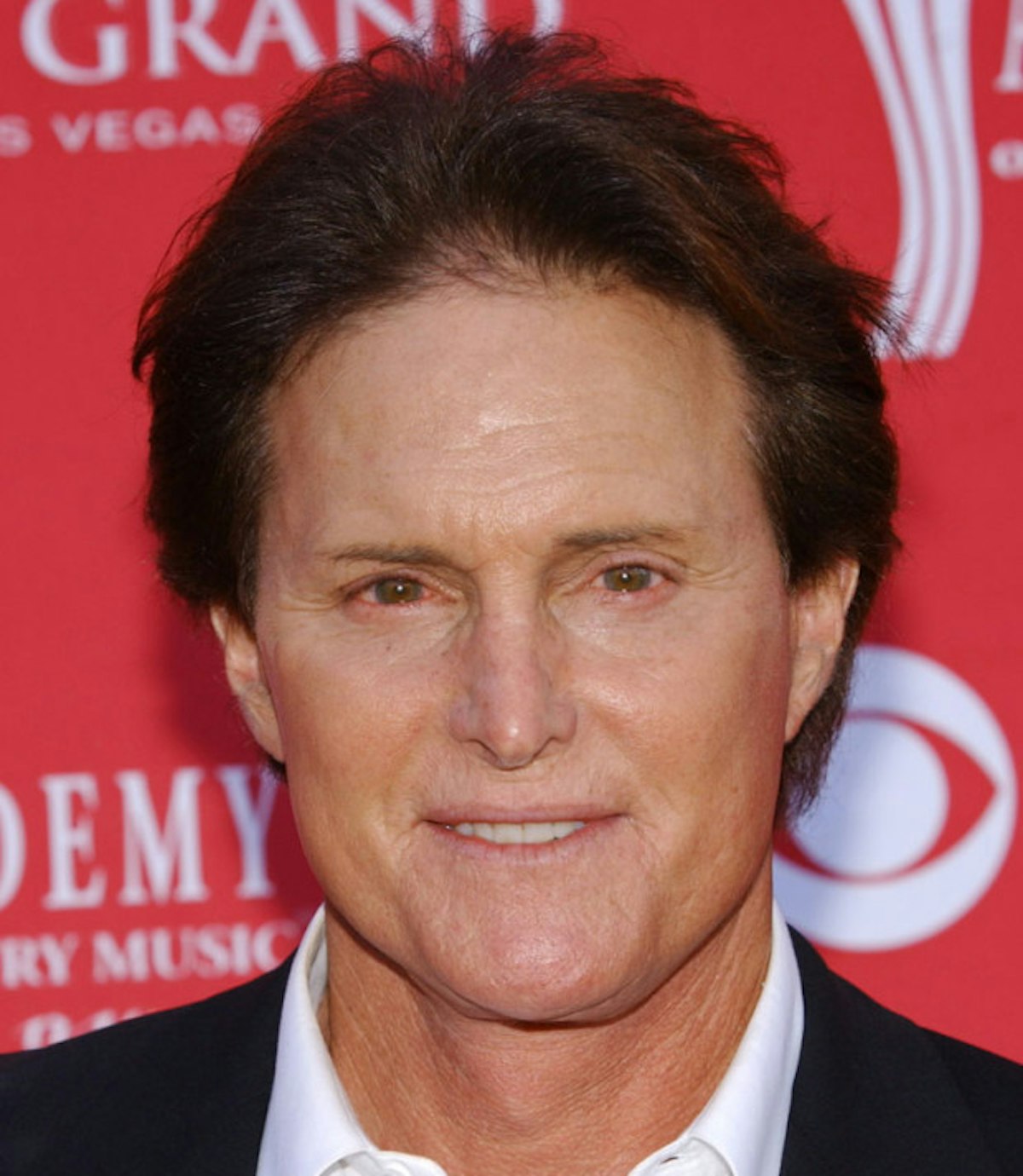 Plastic surgery timeline – the changing face of Bruce Jenner ...
