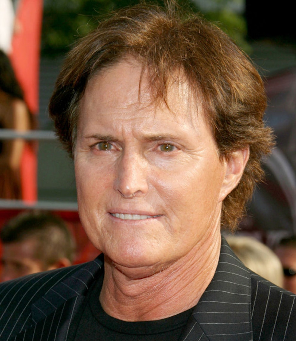 Plastic surgery timeline – the changing face of Bruce Jenner ...