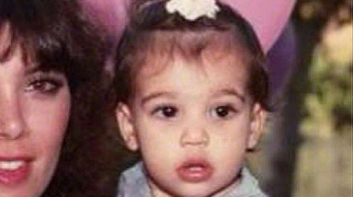Kim Kardashian Before and After Plastic Surgery - Heat