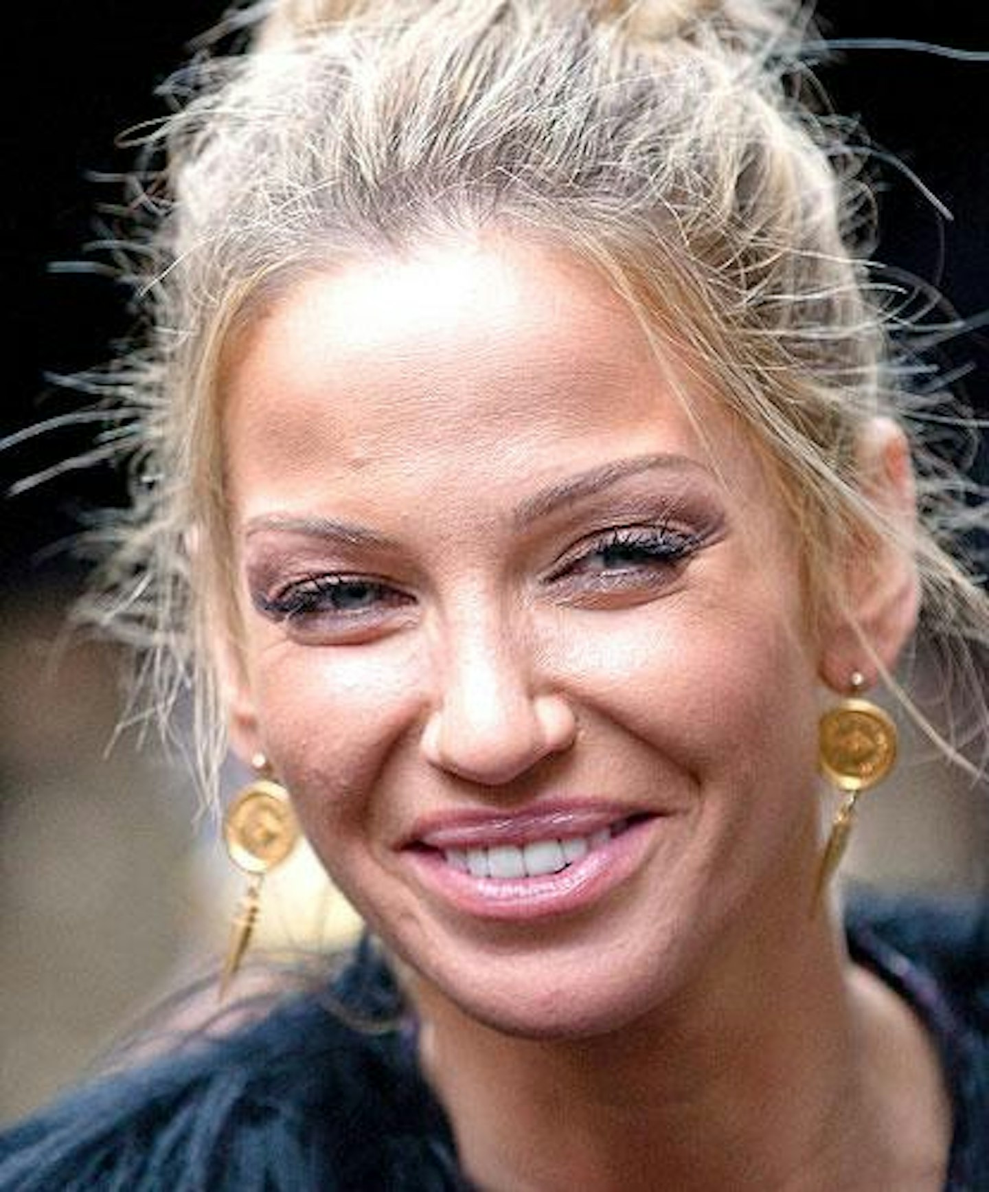 Sarah Harding: ‘I’m worried I’ve lost my looks!’ | Closer