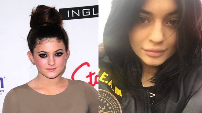 Kylie Jenner Old Face The Changing Face Of Kylie Jenner! | Hair