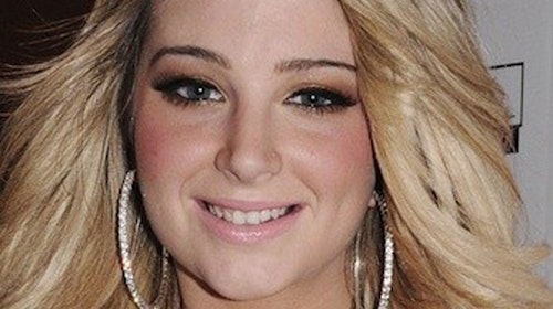 Celebrity teeth before and after! Cheryl Cole, Tulisa Contostavlos and ...