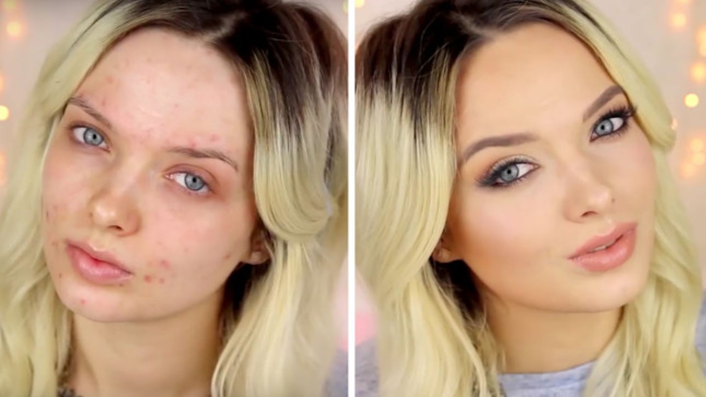 VIDEO How To Cover Acne With Makeup channel name video-how-to-cover-acne-with-makeup-channel-name