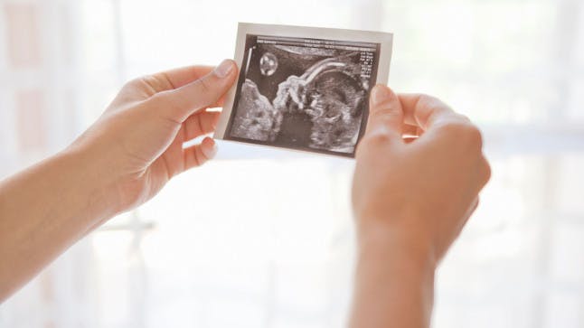 REVEALED: ‘The best and worst months to conceive a healthy baby’ | Closer