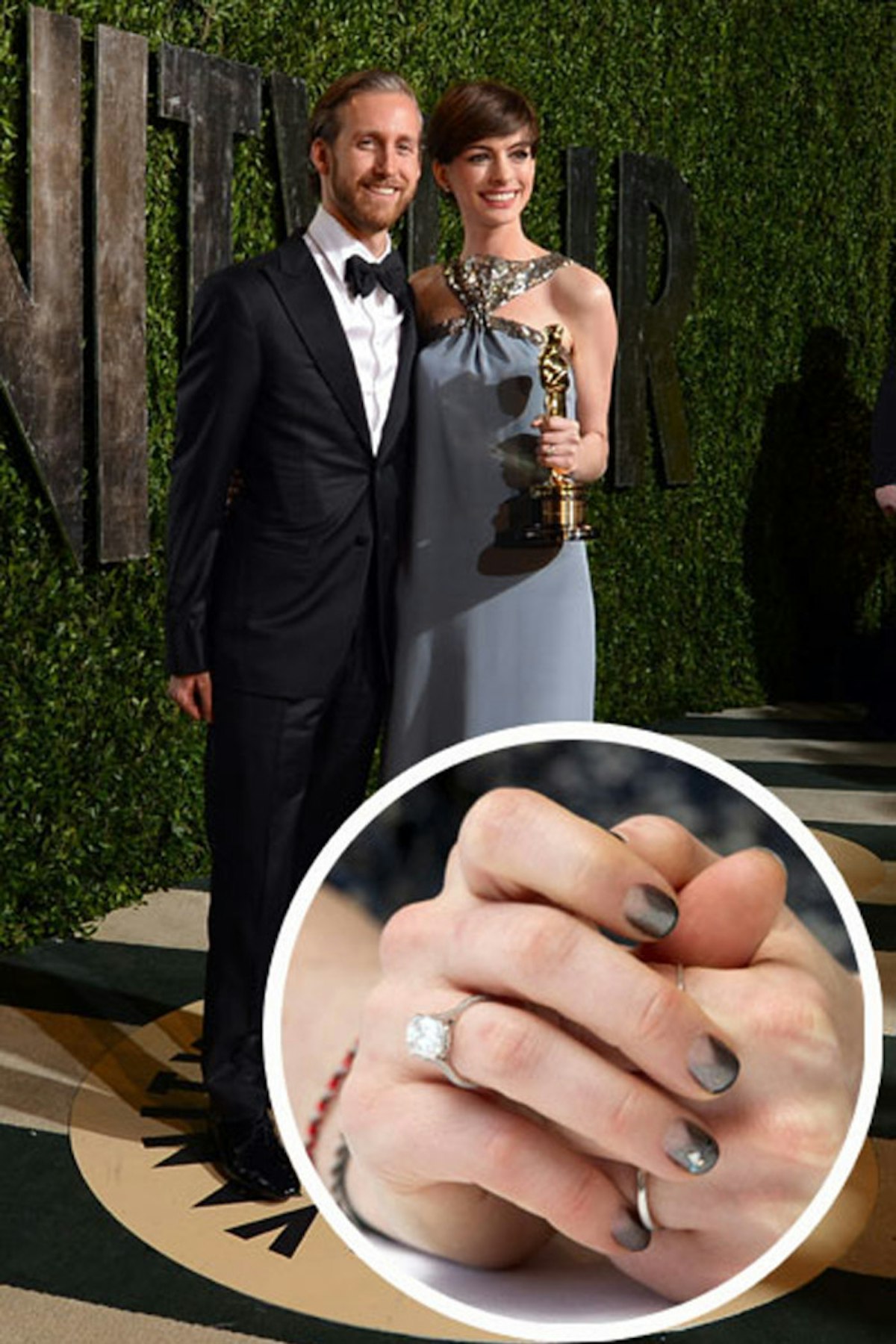Piercing Your Ring Finger Is The Latest Engagement Trend | %%channel_name%%
