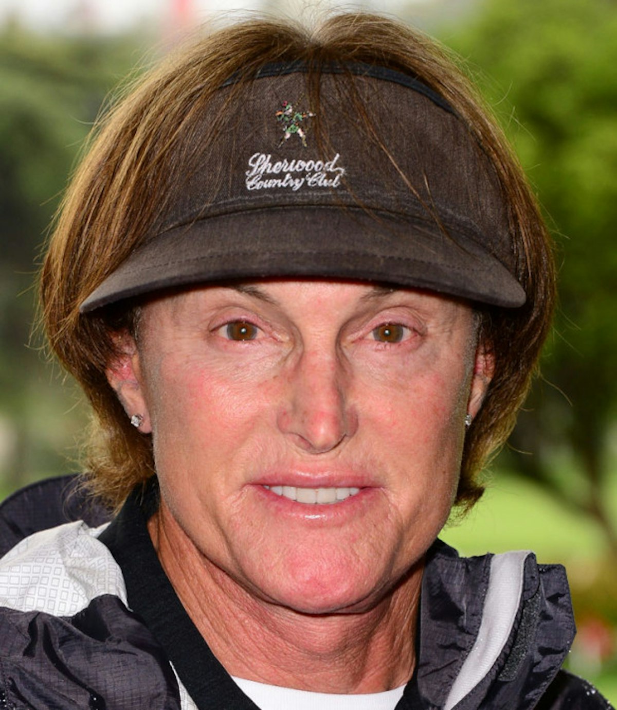 Plastic surgery timeline – the changing face of Bruce Jenner ...