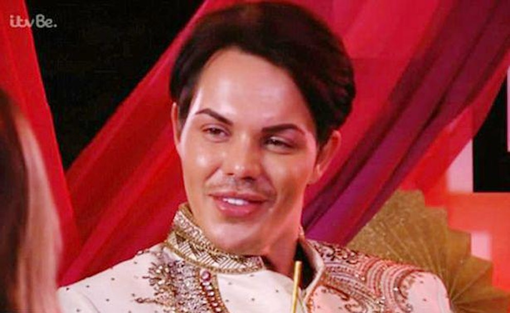 Towie fans shocked by Bobby Norris’ plastic surgery