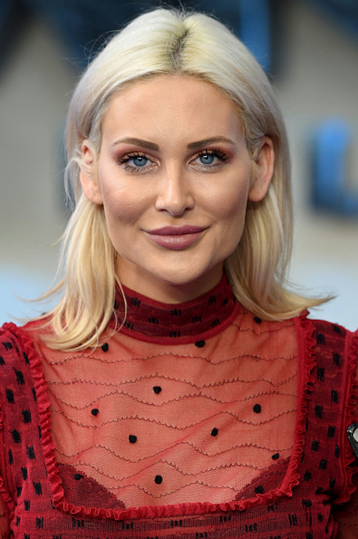Celebrity lip fillers before and after: A transformation gallery