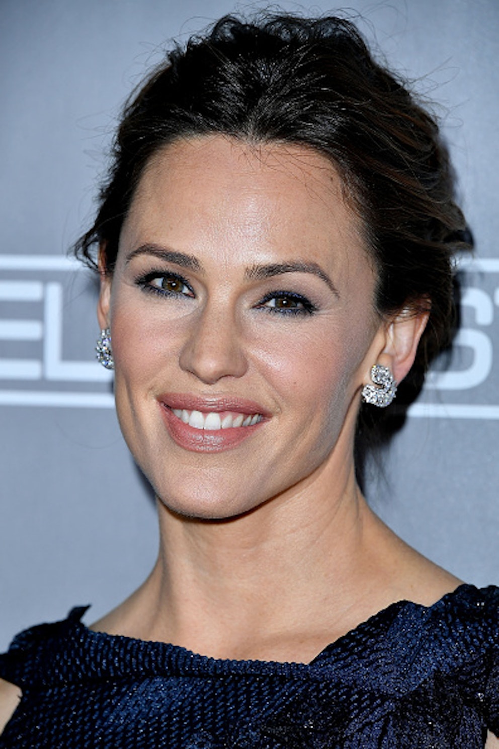 Celebrity lip fillers before and after: A transformation gallery