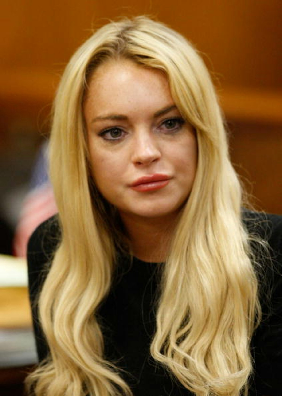 Celebrity lip fillers before and after: A transformation gallery