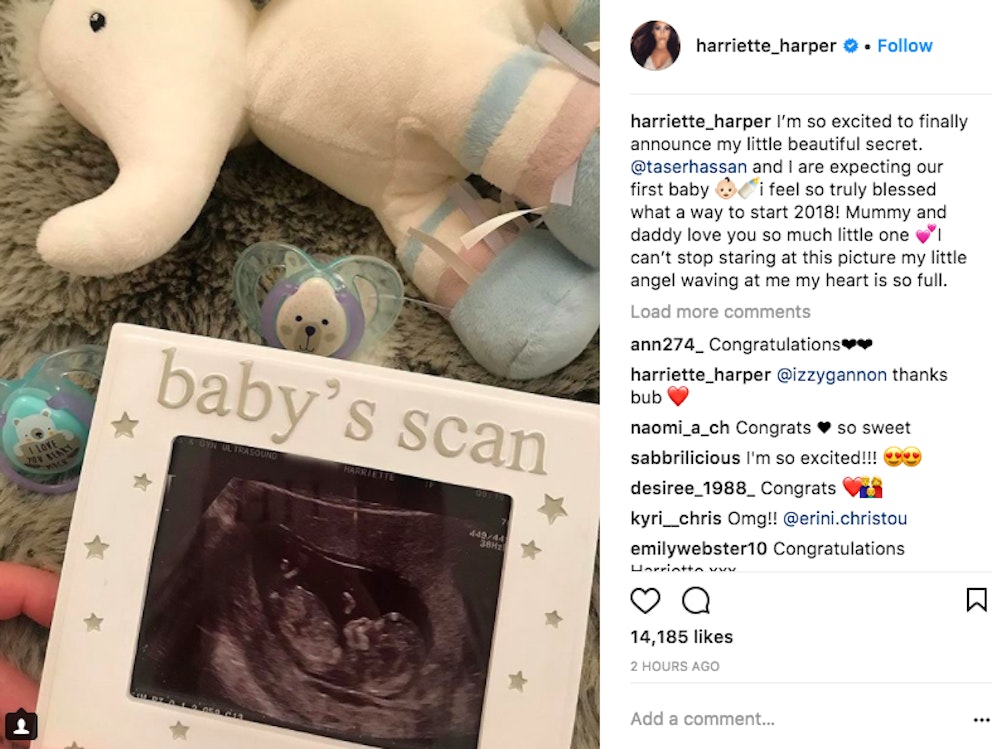 There’s going to be an Ex On The Beach baby!!