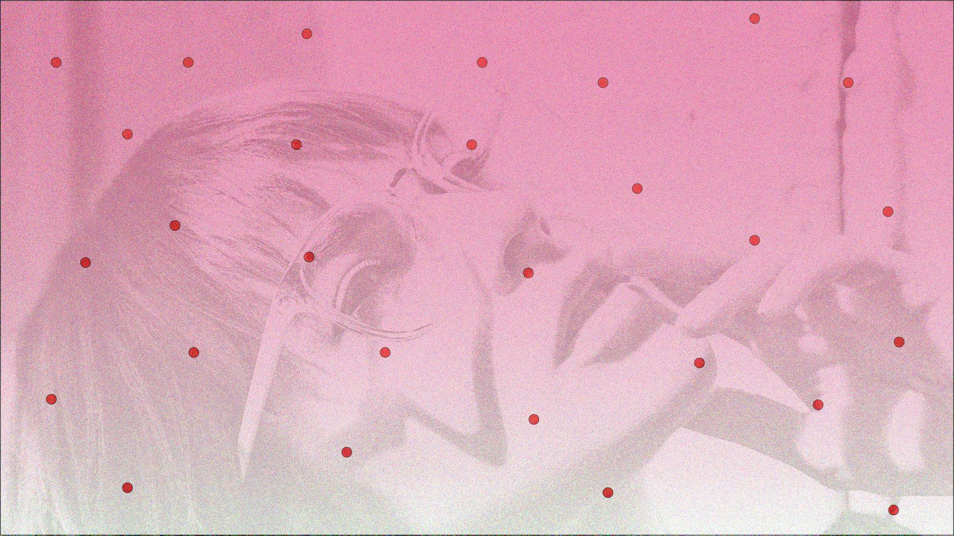 Acne Sufferers Are Much More Likely To Suffer From Depression | Grazia