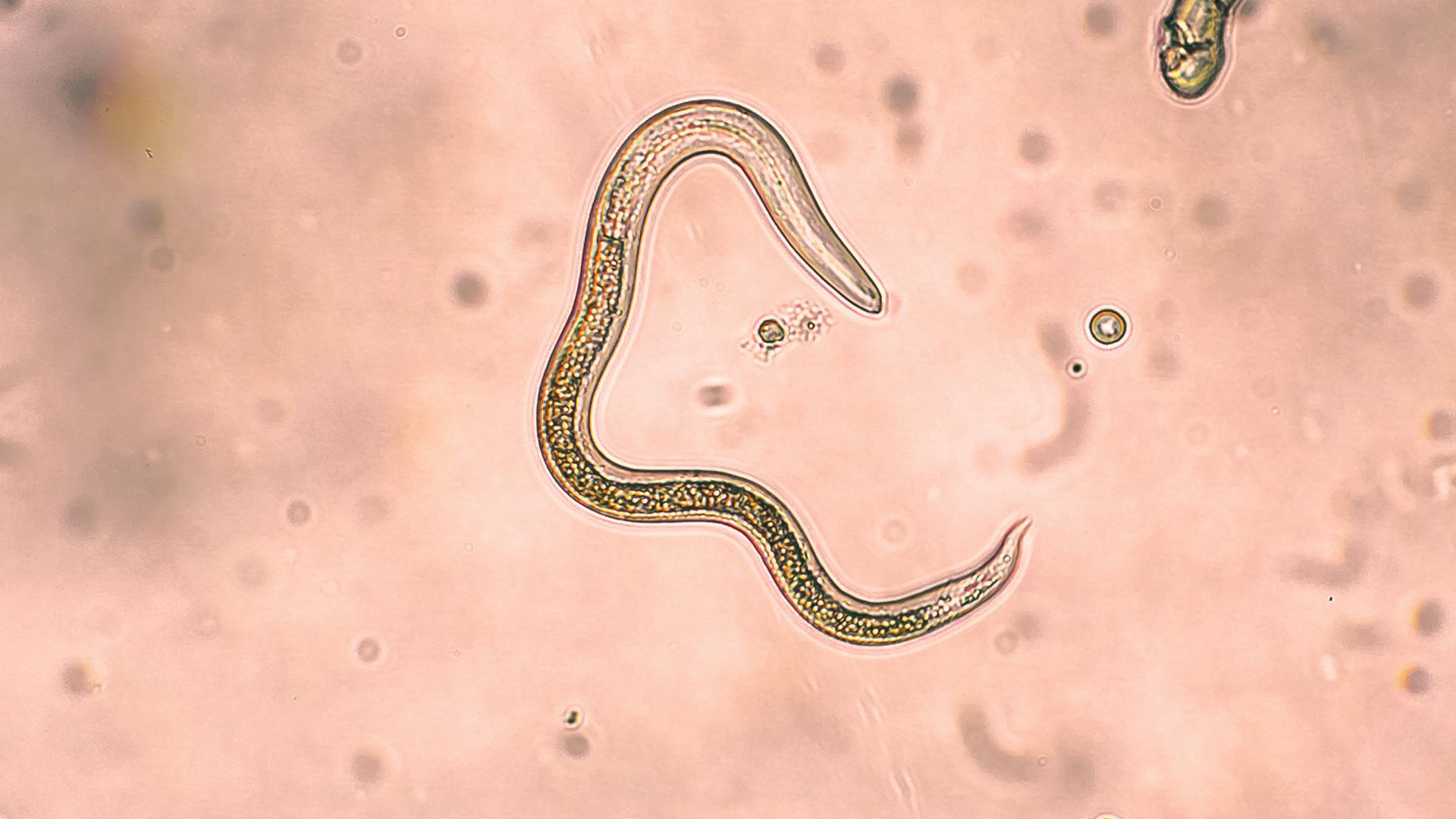 We’re Pretty Grossed Out By The Worms Found In An Oregon Woman’s Eye ...