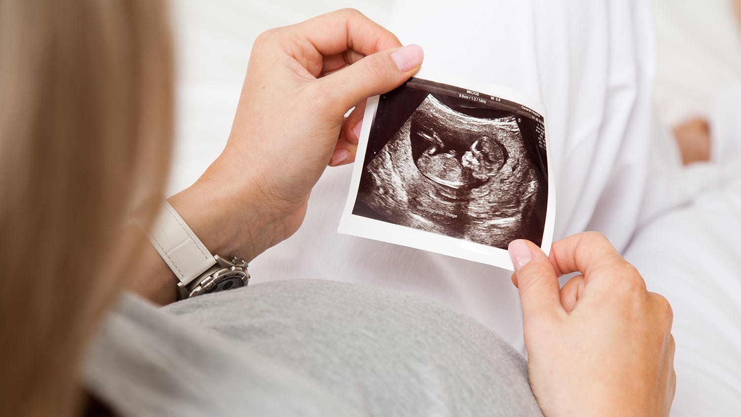 Baby gender prediction: Everything you need to know about the Nub and ...