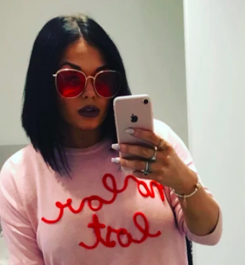 Kris Boyson and Bianca Gascoigne get his 'n' hers hair transplants