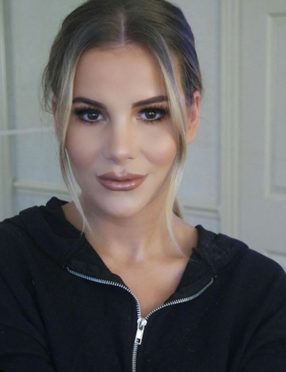 Love Island's Kendall Rae Knight surprises fans with nose surgery