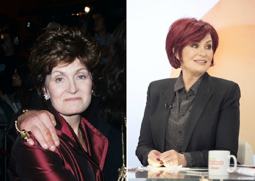 Laura Anderson debuts new look after having cosmetic surgery | Closer