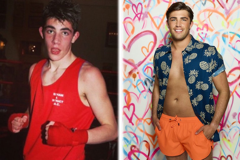 Love Island: Megan Barton looks SO different in pre-surgery snap fans ...