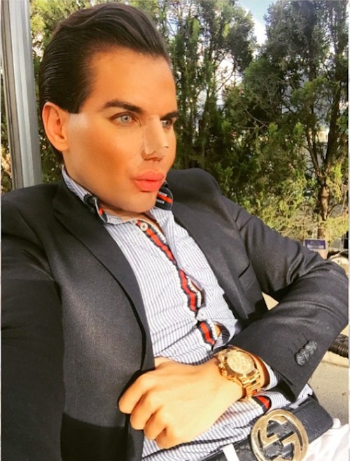 CBB: Rodrigo Alves the Human Ken Doll – the story behind his ROTTING ...