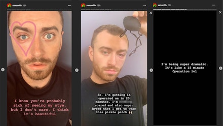 Sam Smith has eye surgery and posts before and after pics | Celebrity ...