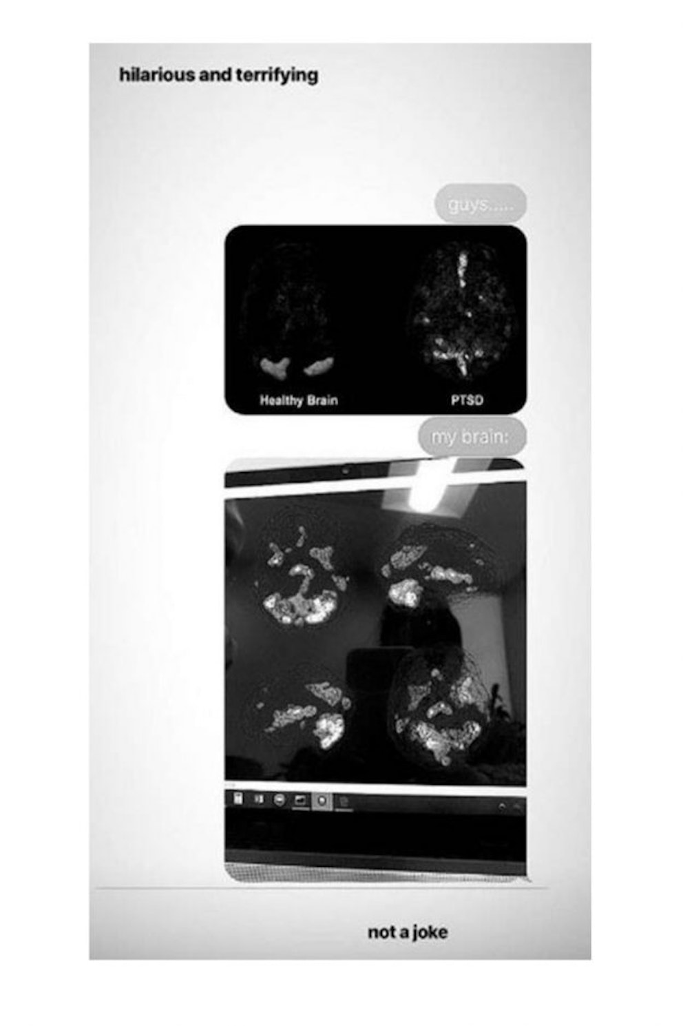 Ariana Grande shares 'terrifying' PTSD brain scan - Closer