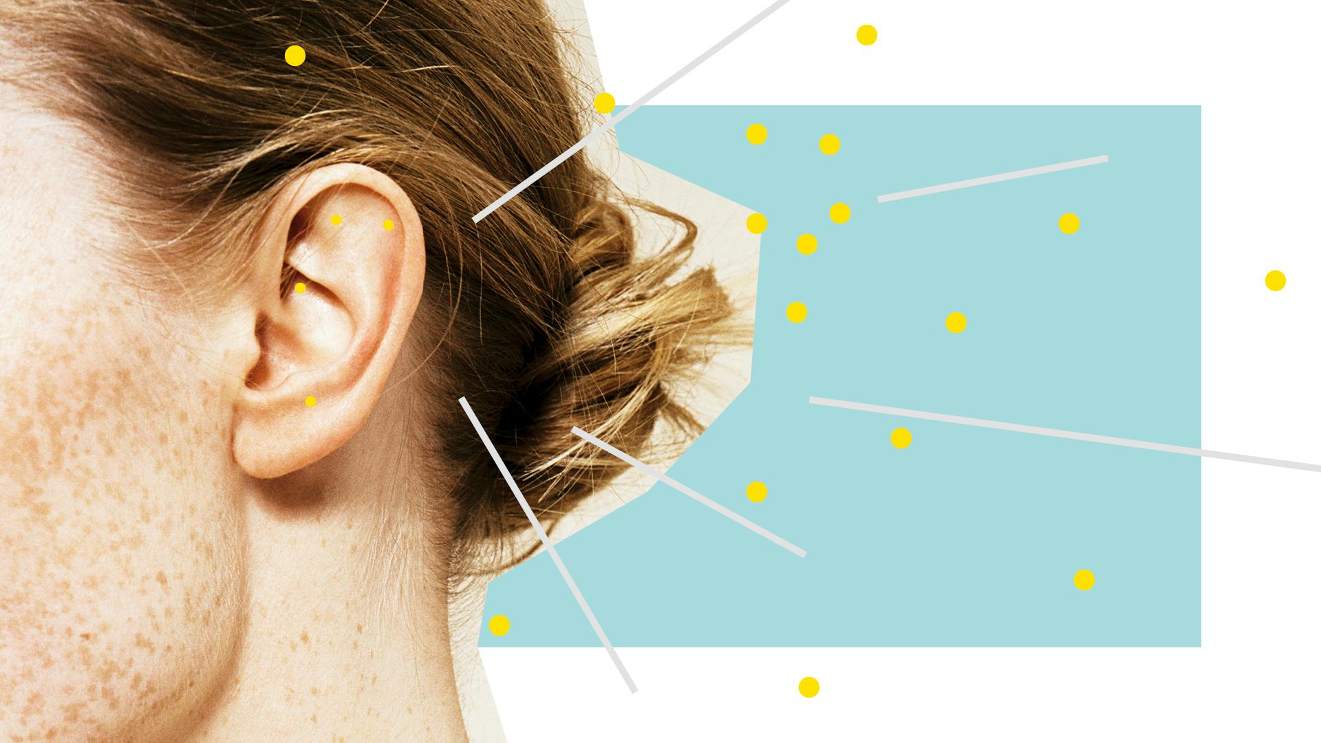 Do Ear Seeds Actually Work And What Are They Exactly Beauty Hair