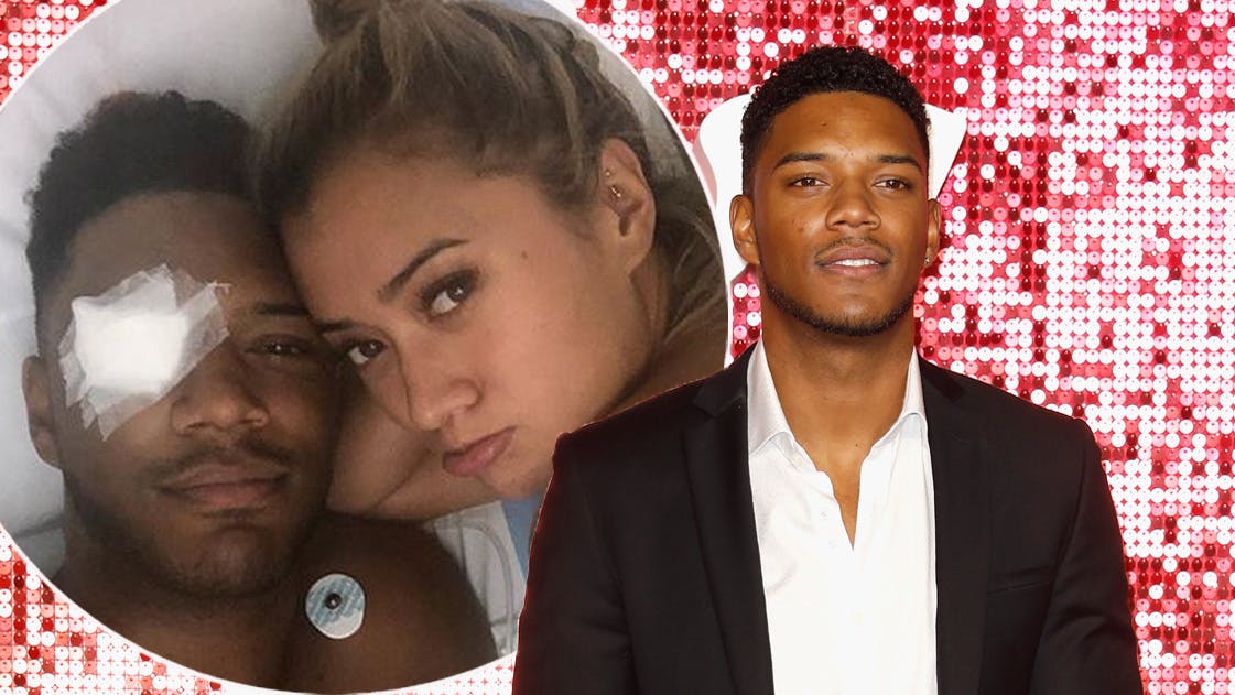 Love Island’s Theo Campbell shares aftermath of accident that lost his eye | Entertainment | Heat
