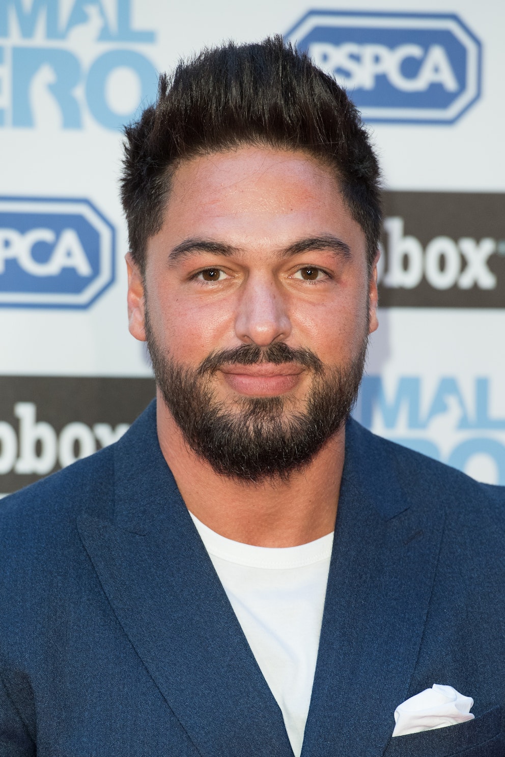 Love Island's Kendall Rae Knight surprises fans with nose surgery