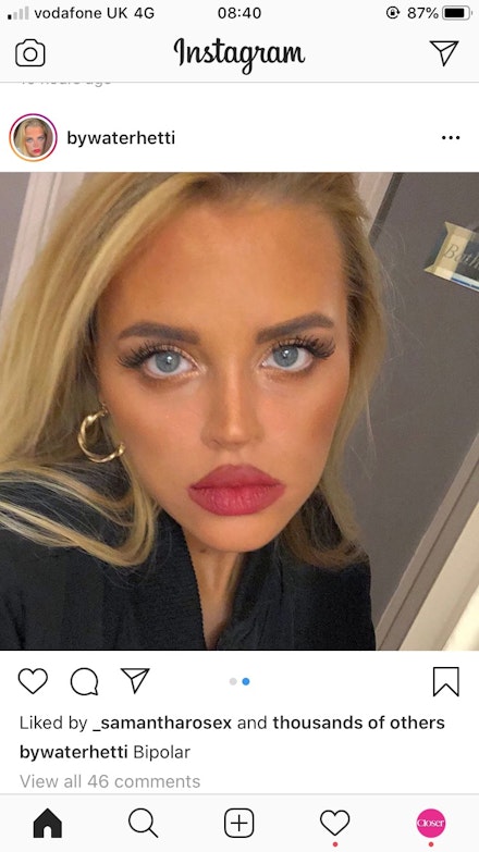 Ex-EastEnder Hetti Bywater questioned over ‘lip fillers’ in ...