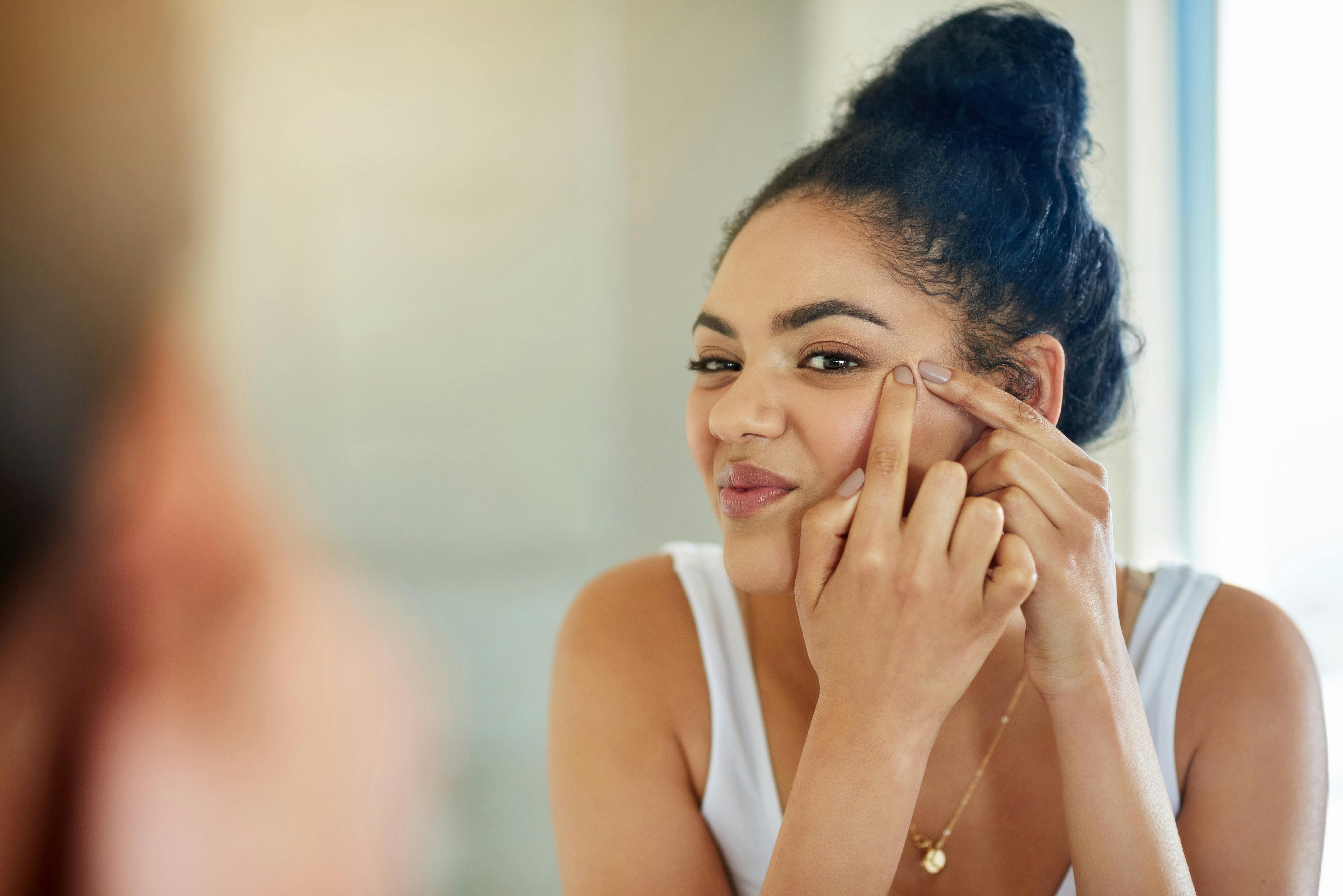 Breakout Breakdown: What Is Actually Causing Your Spots? | Grazia
