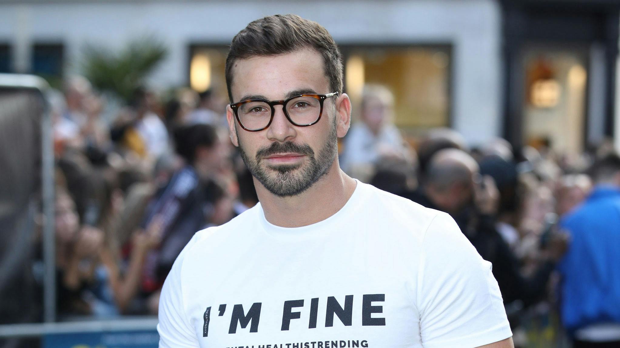 Love Island's Alex Miller reveals he's had a hair transplant