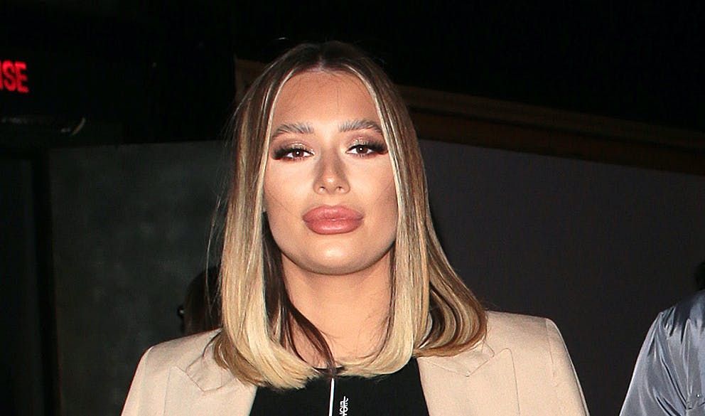TOWIE fans shocked at Demi Sims pre-surgery