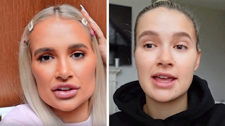 molly-mae-hague-s-u-turn-i-went-too-far-with-fillers-closer