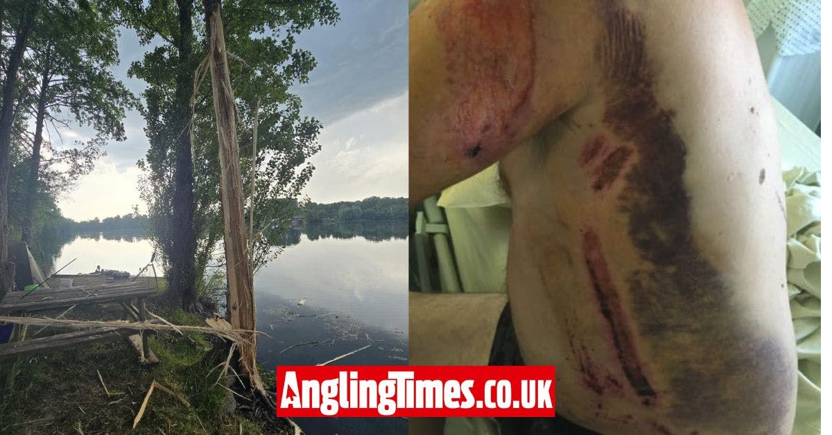 Angler struck by lightning in terrifying reminder to us all | Angling Times
