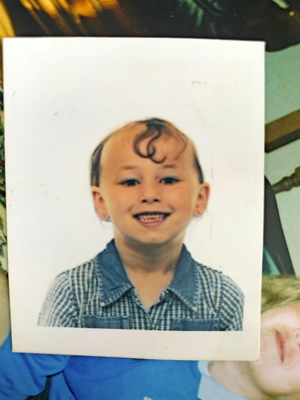 Bald and beautiful | Real Life | Take a Break