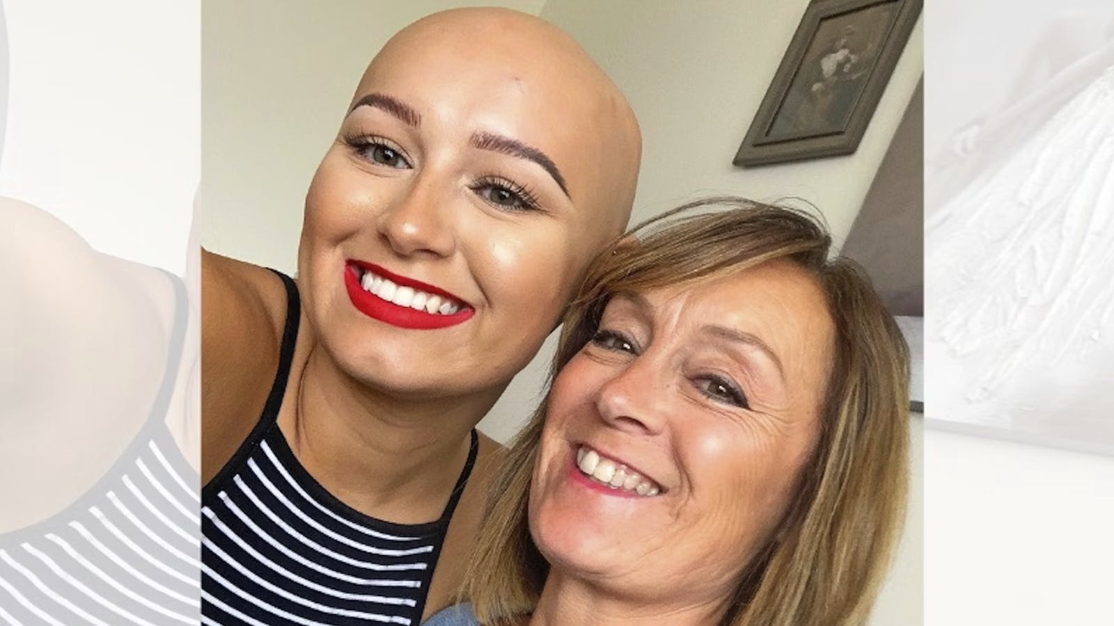 Bald and beautiful | Real Life | Take a Break