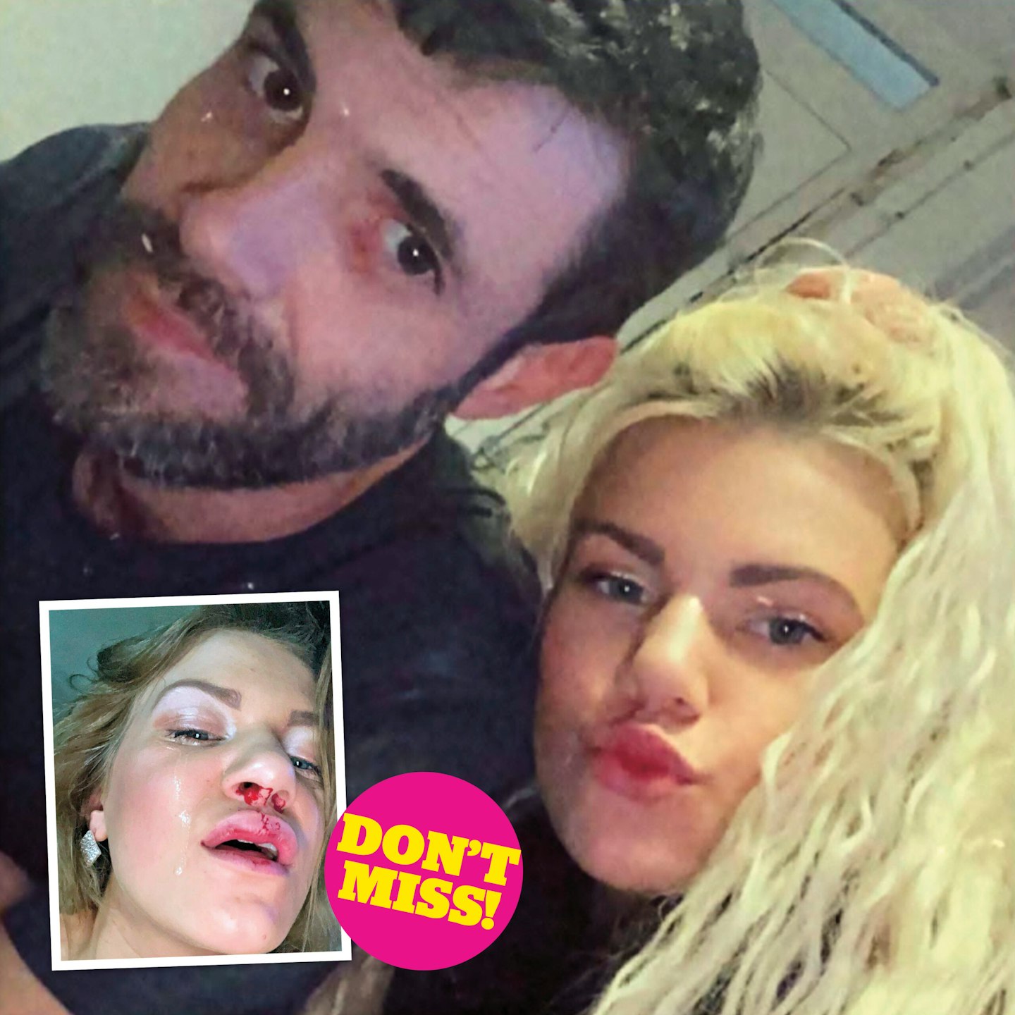 Bridy with her boyfriend Nehemiah, inset Bridy after the attack.